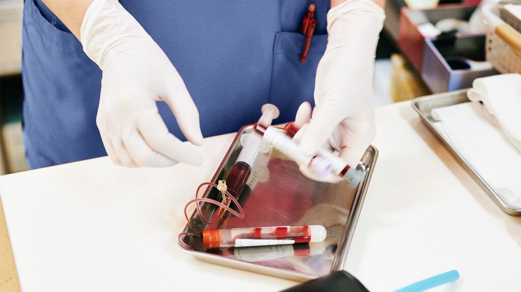 Non-fasting triglyceride test: Recommendations and normal ranges