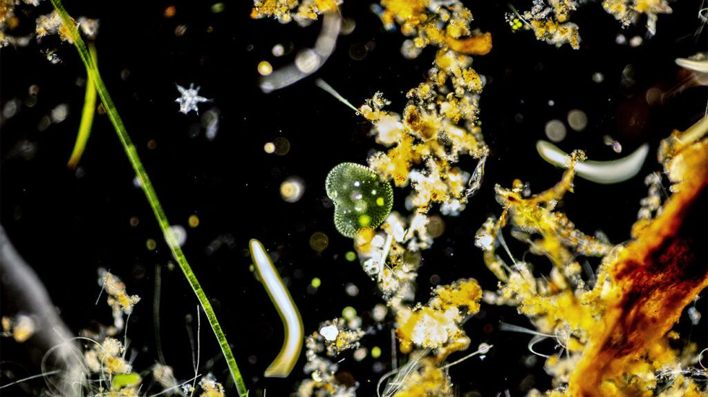 Parasitic infections: Types, symptoms, treatment