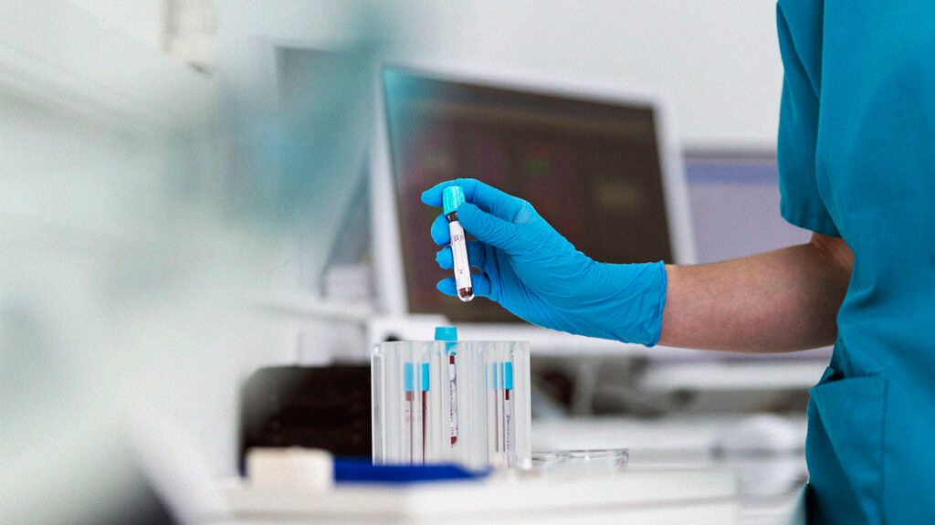 How long does it take to show symptoms of HIV? Timeline and more