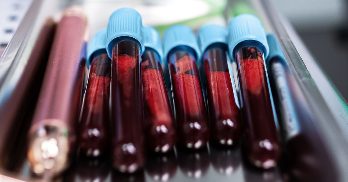 Breast cancer: Blood test may predict which treatment will work best