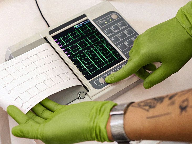 High lipoprotein(a) levels linked with long-term heart disease risk