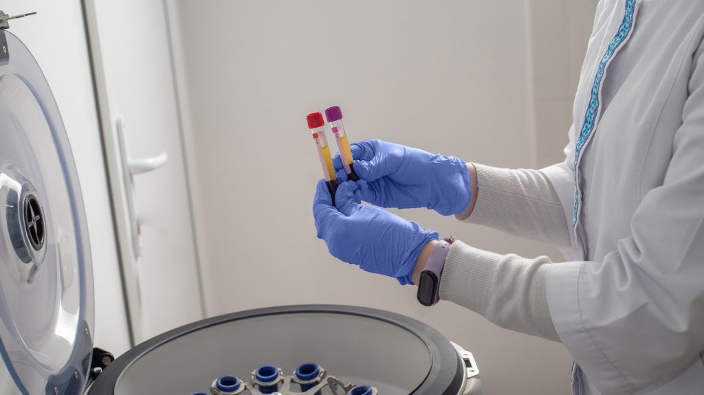 New ‘SECmere’ blood test could spot Alzheimer’s-related changes sooner