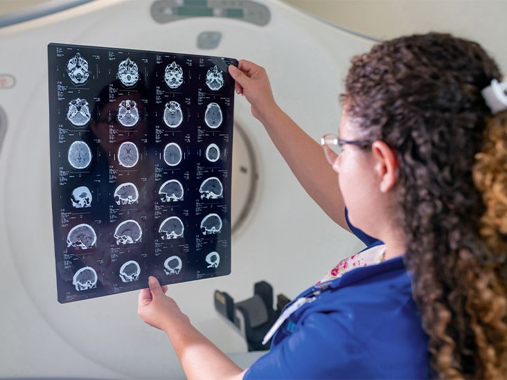 A Look Inside the Mind of Schizophrenia | Psych Central