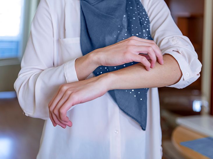 Anxiety and Itching: Why It Happens and What to Do