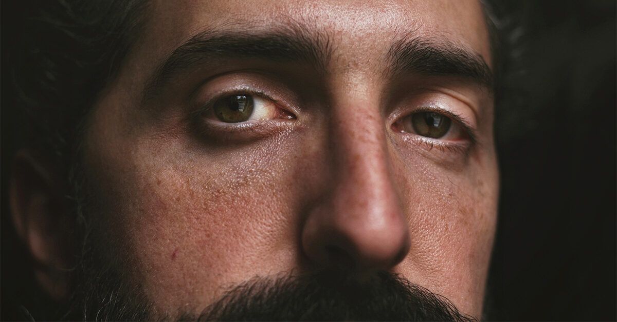 Can You Become Addicted to Fentanyl?