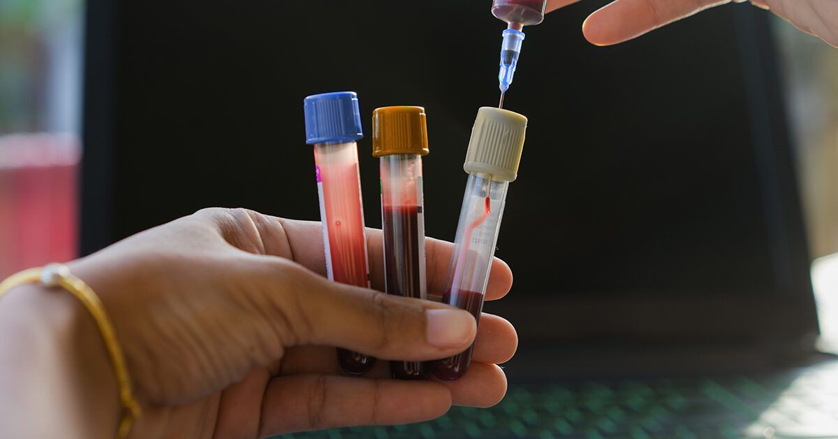 What Labs Are Monitored for Psychiatric Medications? I Psych Central