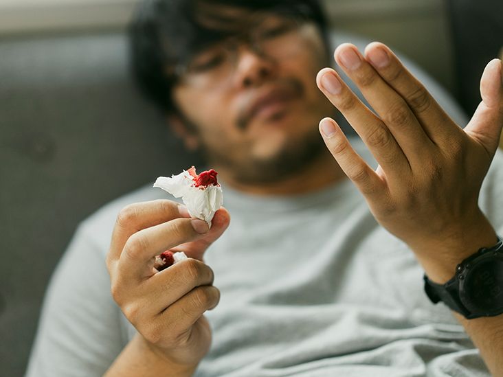 Stress and Nosebleeds: What's the Link?