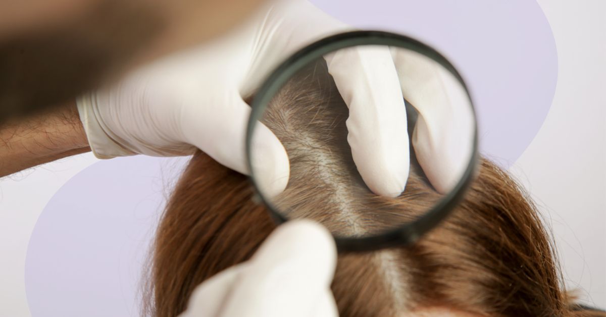 IBD and Skin Cancer: What's the Link?