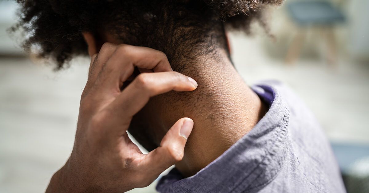 Itchy Skin with Rheumatoid Arthritis: Potential Causes and Treatments